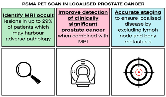 The Performance and Role of PSMA PET Scans in Localised Prostate Cancer