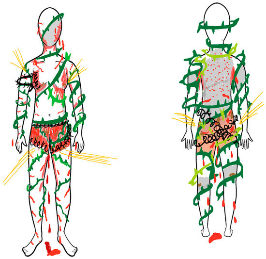 “It’s Like Having an Uncontrolled Situation”: Using Body Maps to ...