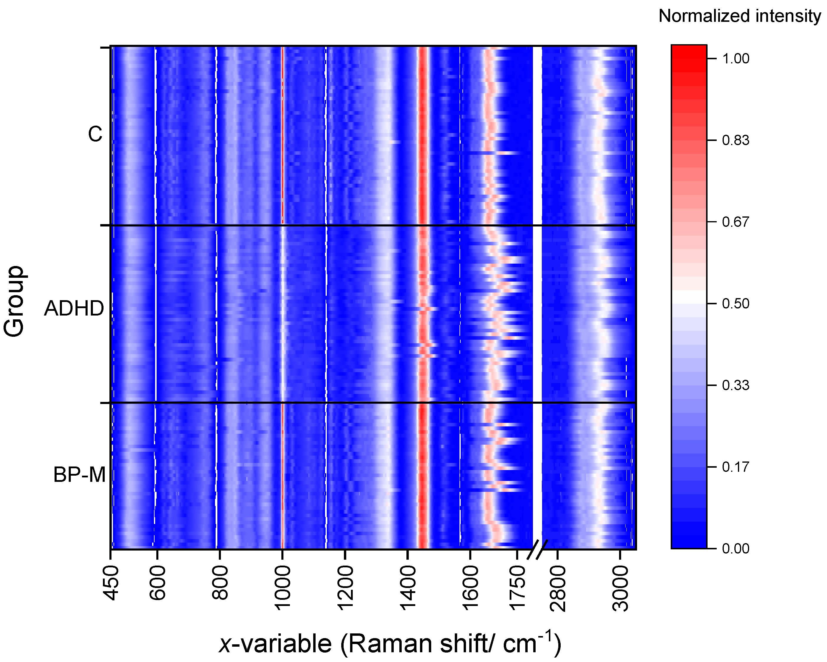 Spectroscopy Journal | Free Full-Text | Raman Spectra of Blood Serum as Holistic Biomarker for ...