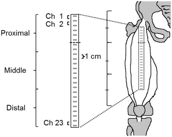 Sports | Free Full-Text | Central Tendon Injury Impairs Regional ...