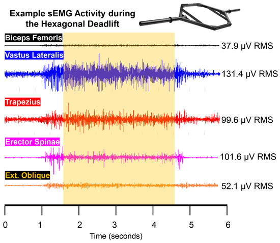 Acute, Non-Specific Low Back Pain Does Not Impair Isometric Deadlift ...