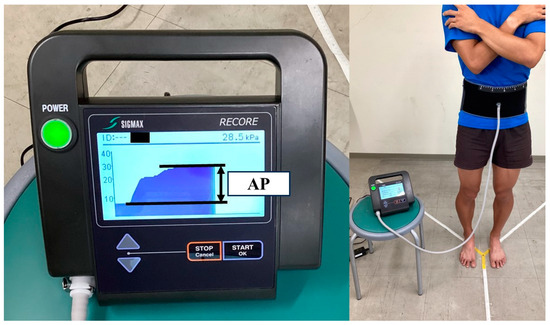 Effects of External Abdominal Pressure Support on Dynamic Balance: A ...