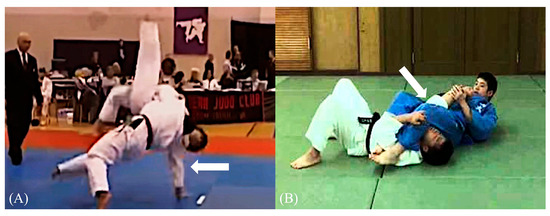 Incidence of Elbow Injury Patterns in Japanese Adolescent Judo Players ...