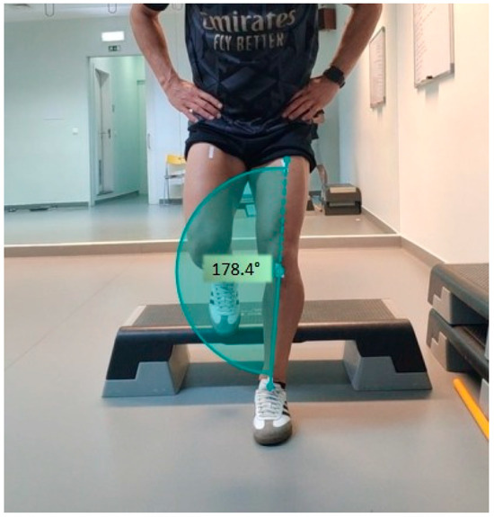 Anthropometric Characteristics, Age, Sex, Drop Height, and Visual ...