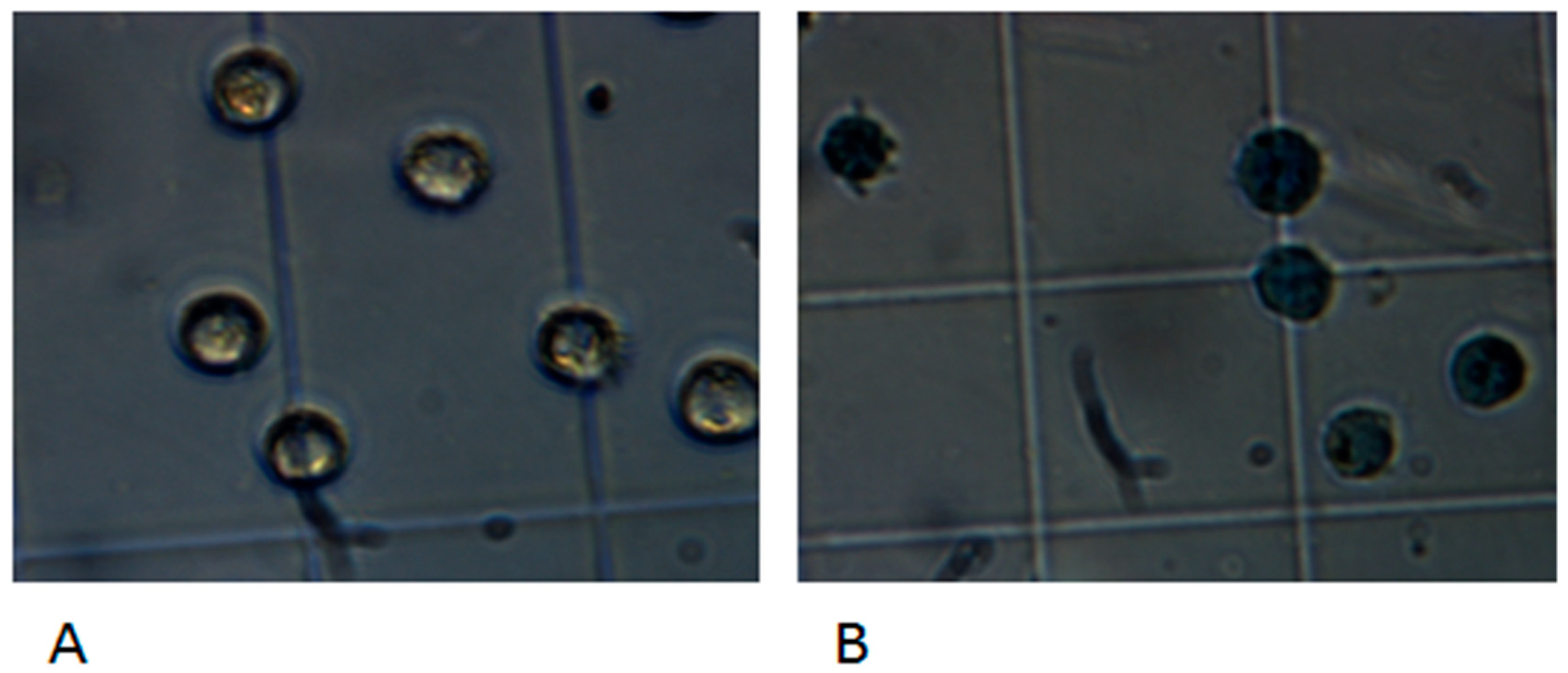Interaction of Vibrio to Biotic and Abiotic Surfaces: Relationship ...