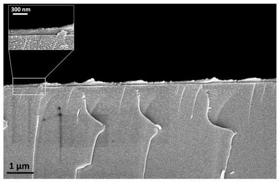 Surfaces | Free Full-Text | The Antibacterial Performance of Implant ...
