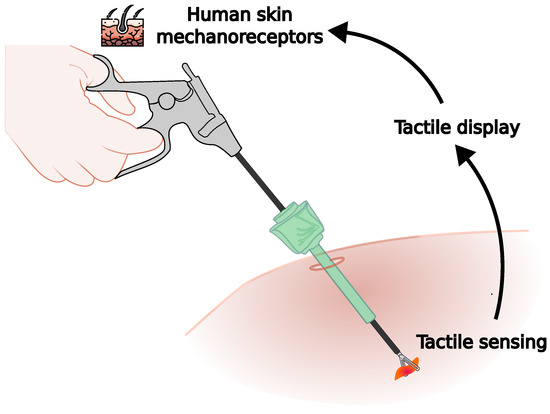 A Review on Tactile Displays for Conventional Laparoscopic Surgery