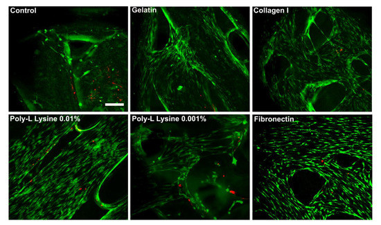 Primary Human Ligament Fibroblast Adhesion and Growth on 3D-Printed ...