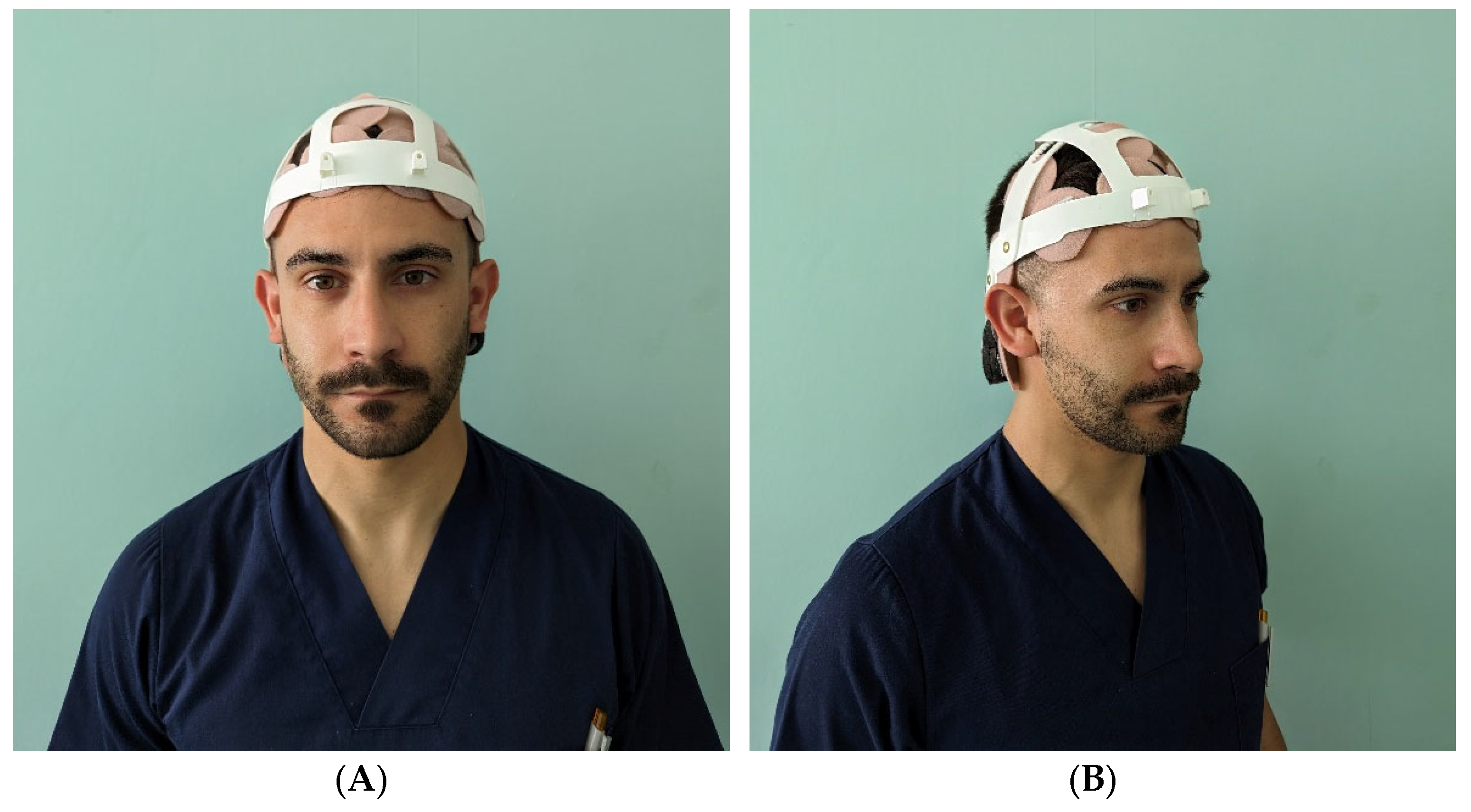 Head Regional Differences in Thermal Comfort: Evaluating a Novel ...