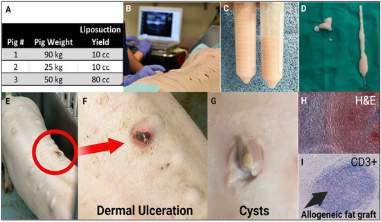 Utilizing a Porcine Fat Grafting Model for Translational Research ...