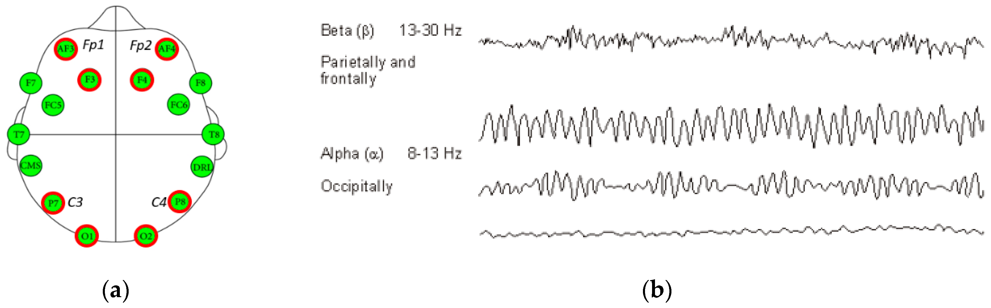 Use of Electroencephalography (EEG) for the Analysis of Emotional ...