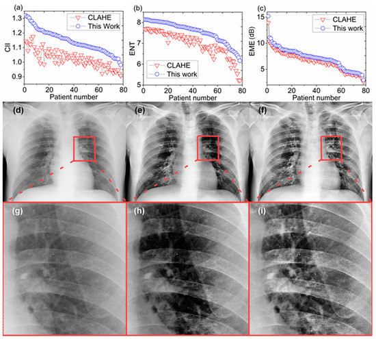 Pipeline for Advanced Contrast Enhancement (PACE) of Chest X-ray in ...