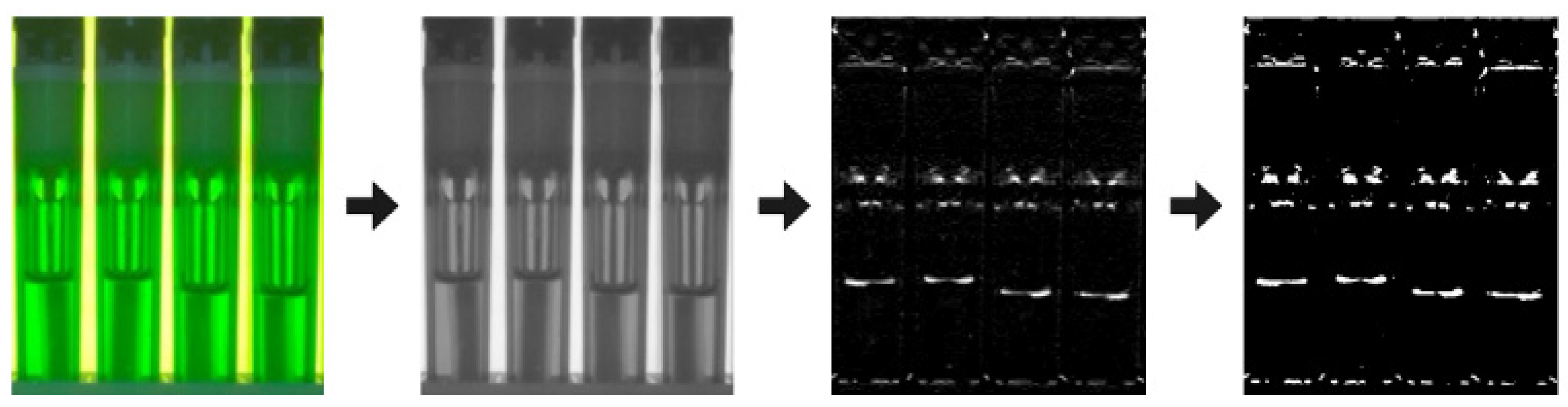 Deep Learning-Based Defect Detection for Sustainable Smart Manufacturing