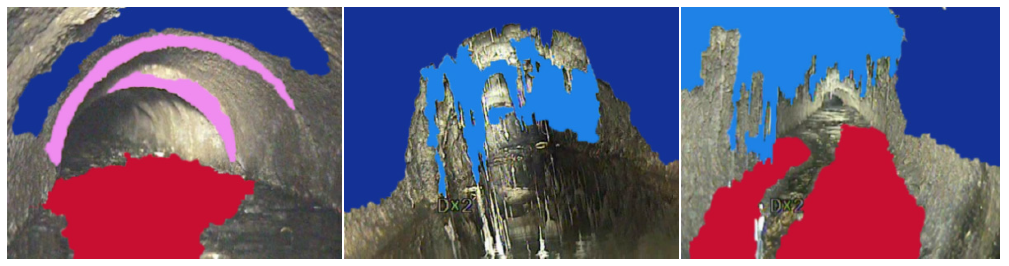 Image Segmentation of a Sewer Based on Deep Learning