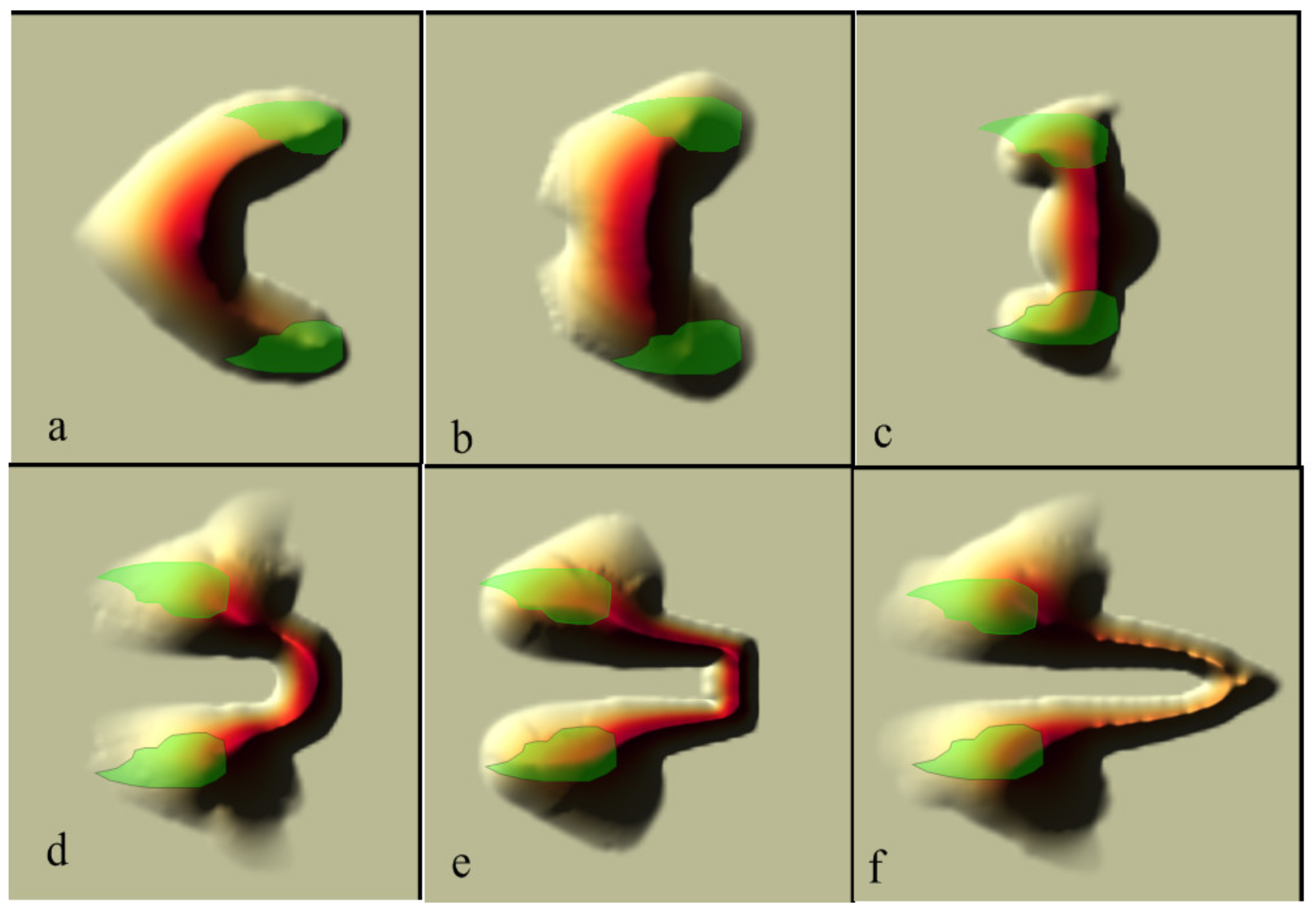 Numerical Simulation Analysis of the Formation and Morphological ...