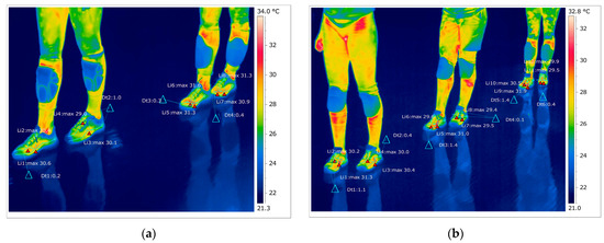 Thermal Transfer Analysis for Sports Footwear, for Performance Athletes ...