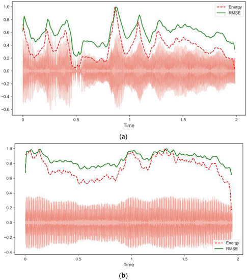 Voice Pathology Detection Using a Two-Level Classifier Based on Combined CNN–RNN Architecture
