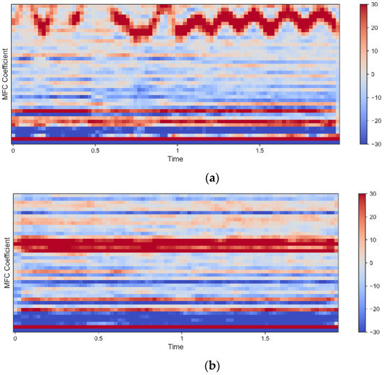 Voice Pathology Detection Using a Two-Level Classifier Based on Combined CNN–RNN Architecture