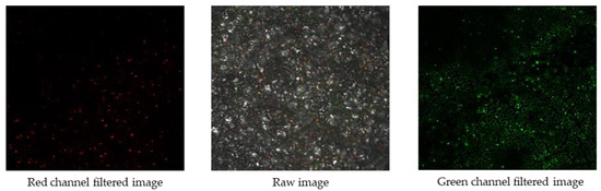 Sustainable Utilization of Machine-Vision-Technique-Based Algorithm in ...