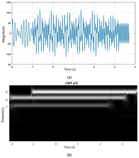 PFT: A Novel Time-Frequency Decomposition of BOLD fMRI Signals for Autism Spectrum Disorder ...