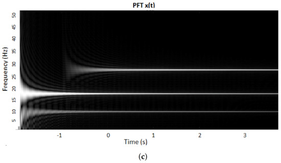 PFT: A Novel Time-Frequency Decomposition of BOLD fMRI Signals for ...