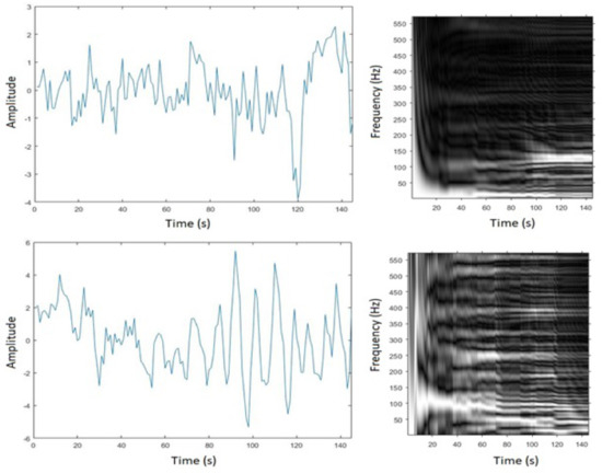 PFT: A Novel Time-Frequency Decomposition of BOLD fMRI Signals for ...