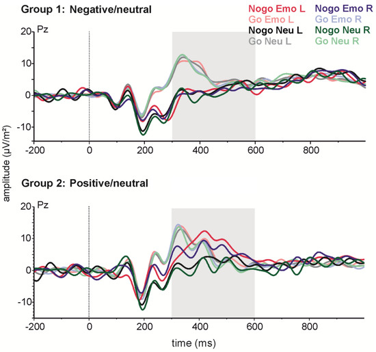 Symmetry | Special Issue : Brain Asymmetry of Structure and/or Function Symmetry | Special Issue : Brain Asymmetry of Structure and/or Function