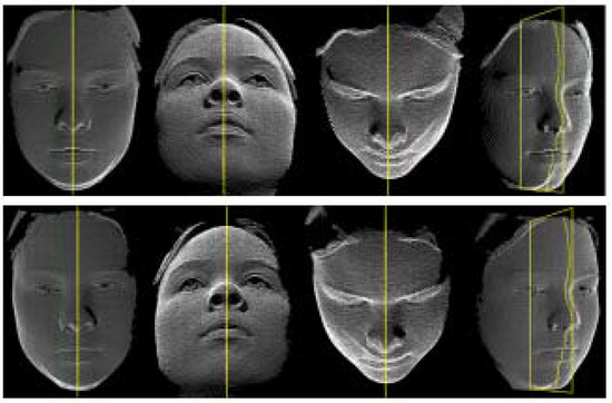 A Survey of Methods for Symmetry Detection on 3D High Point Density ...