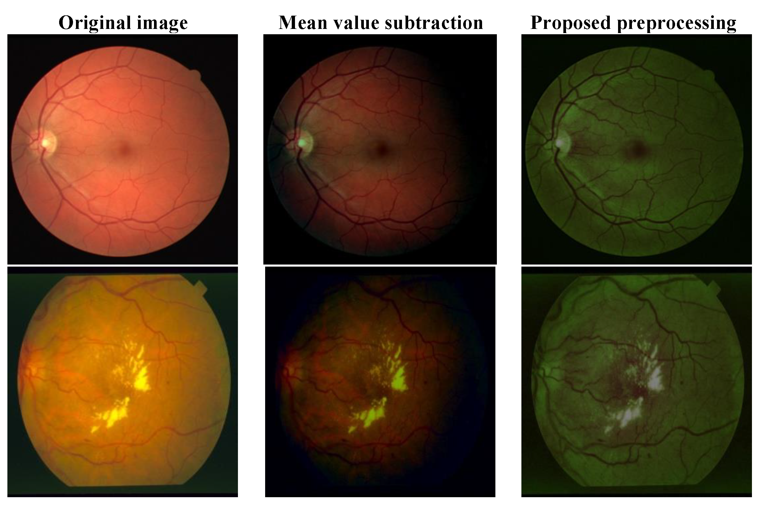 Symmetry | Free Full-Text | Multilevel and Multiscale Deep Neural ...