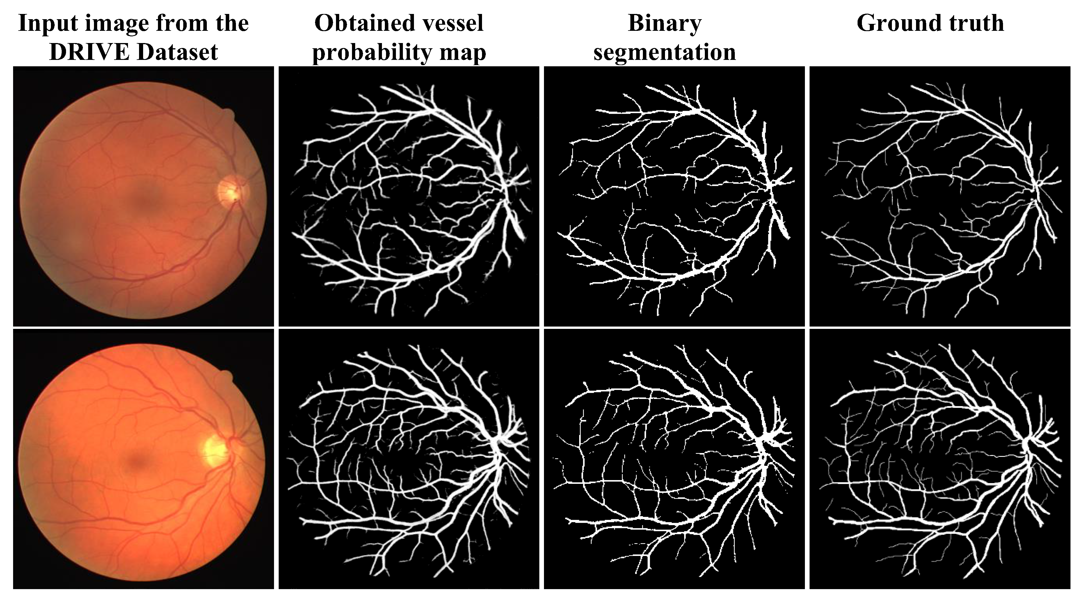 Symmetry | Free Full-Text | Multilevel and Multiscale Deep Neural ...