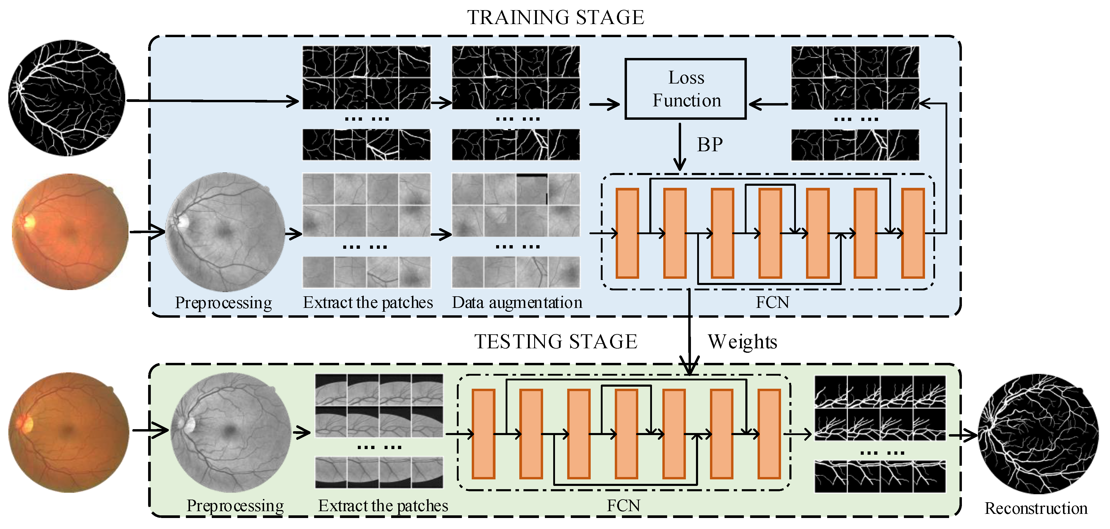 Retinal Vessel Segmentation Based On Fully Convolutional Networks Images Retinal Vessel Segmentation Based On Fully Convolutional Networks Images