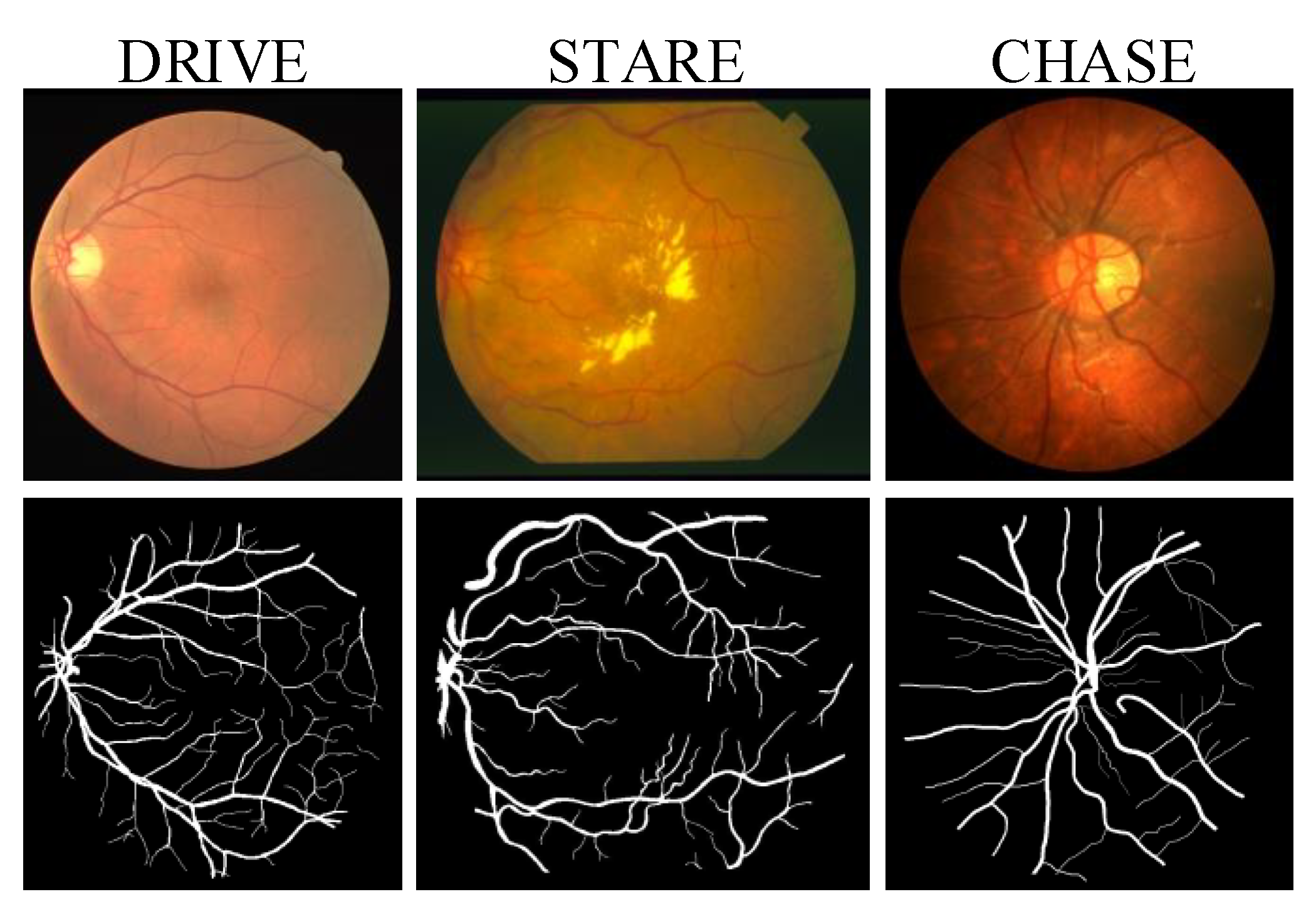 Process Of Retinal Vessel Segmentation Using Mlp Images Process Of Retinal Vessel Segmentation Using Mlp Images