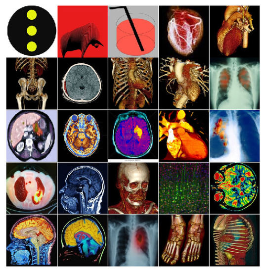 Lossless Image Compression Techniques: A State-of-the-Art Survey