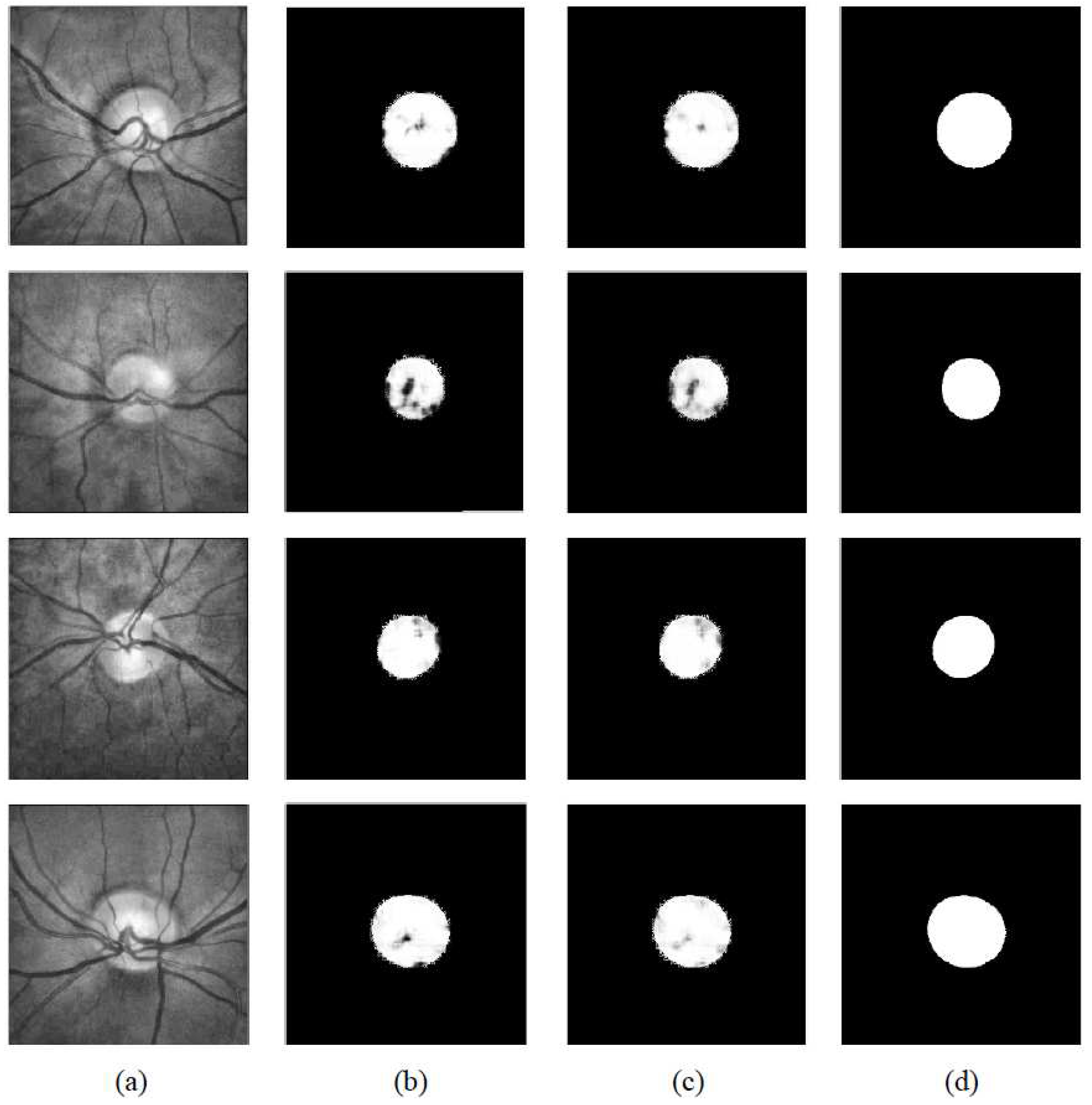 Weakly Supervised and Semi-Supervised Semantic Segmentation for Optic ...