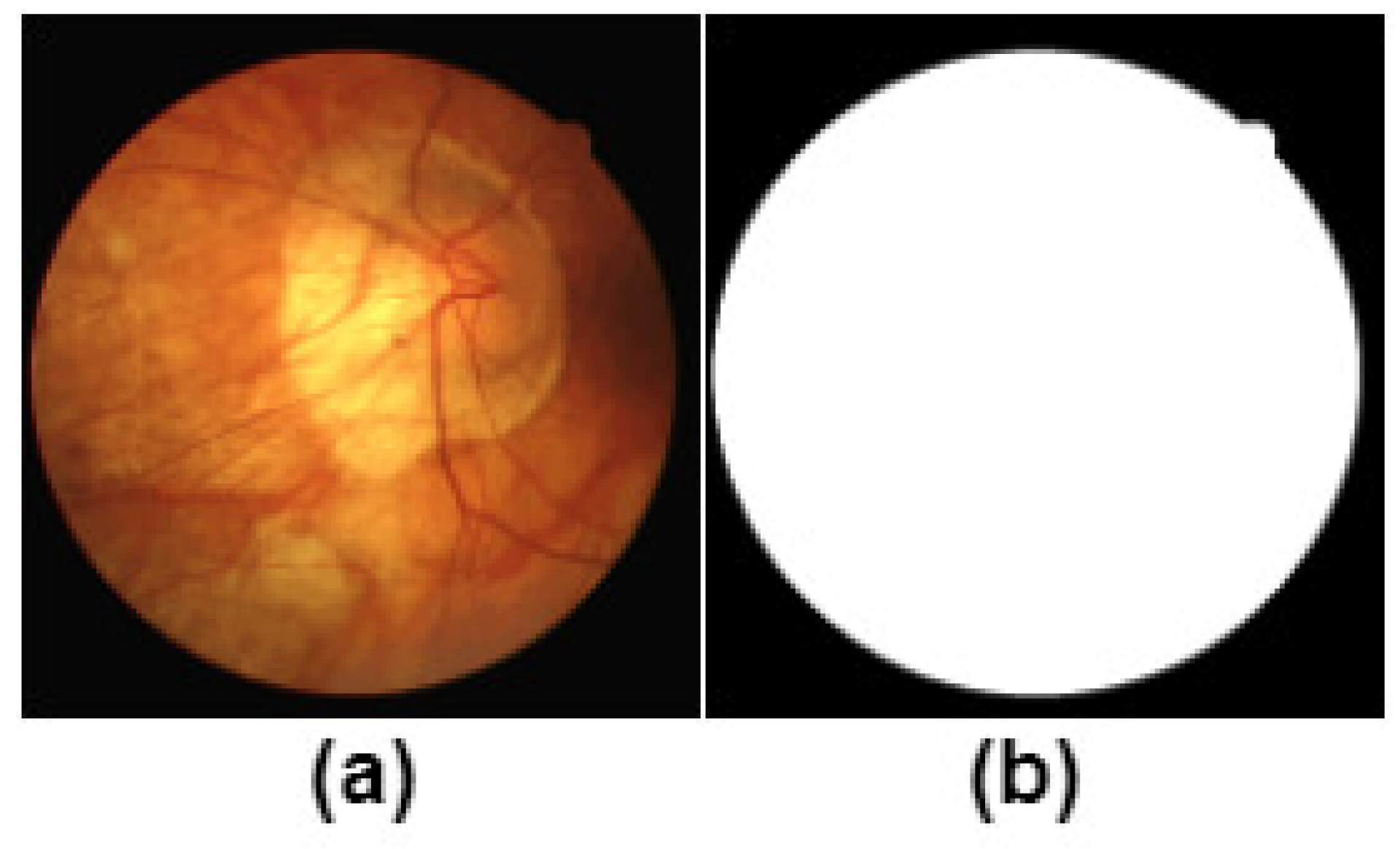 Process Of Retinal Vessel Segmentation Using Mlp Images Process Of Retinal Vessel Segmentation Using Mlp Images