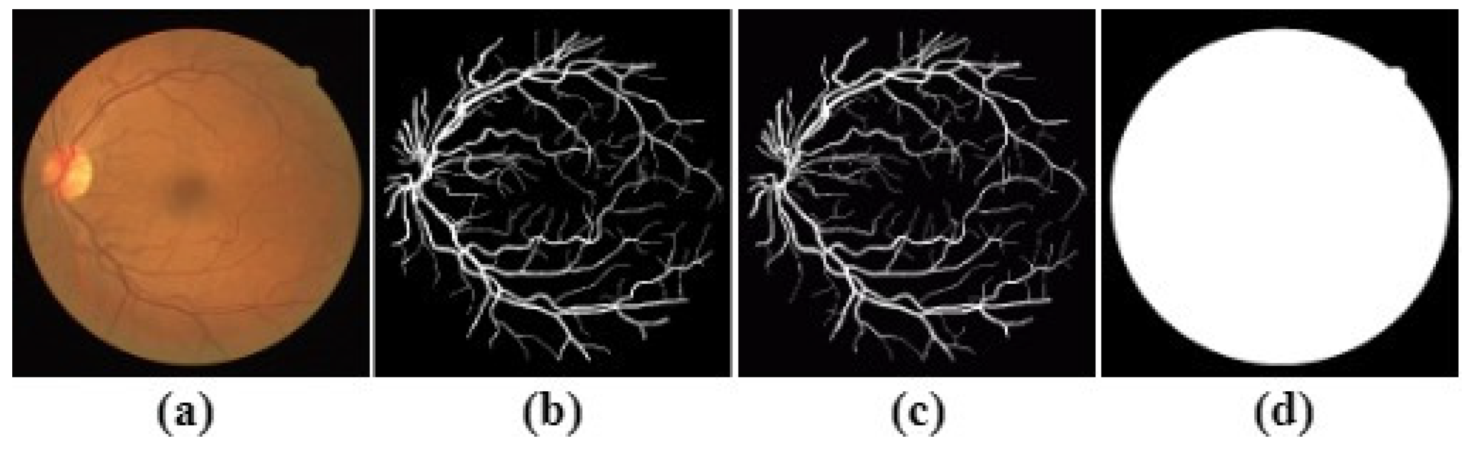 Retinal Blood Vessel Segmentation Using Hybrid Features and Multi-Layer ...