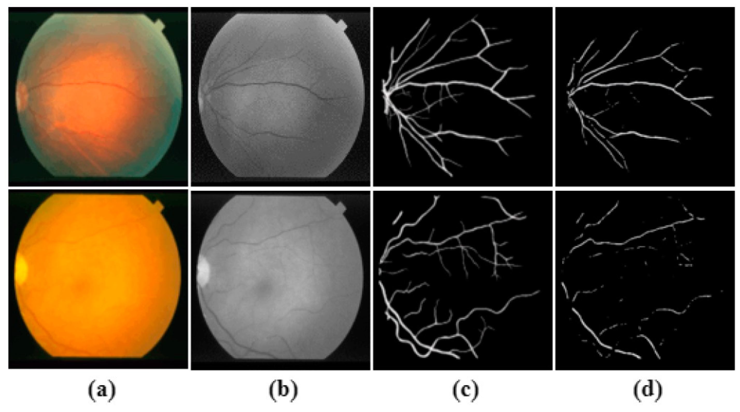 Process Of Retinal Vessel Segmentation Using Mlp Images Process Of Retinal Vessel Segmentation Using Mlp Images