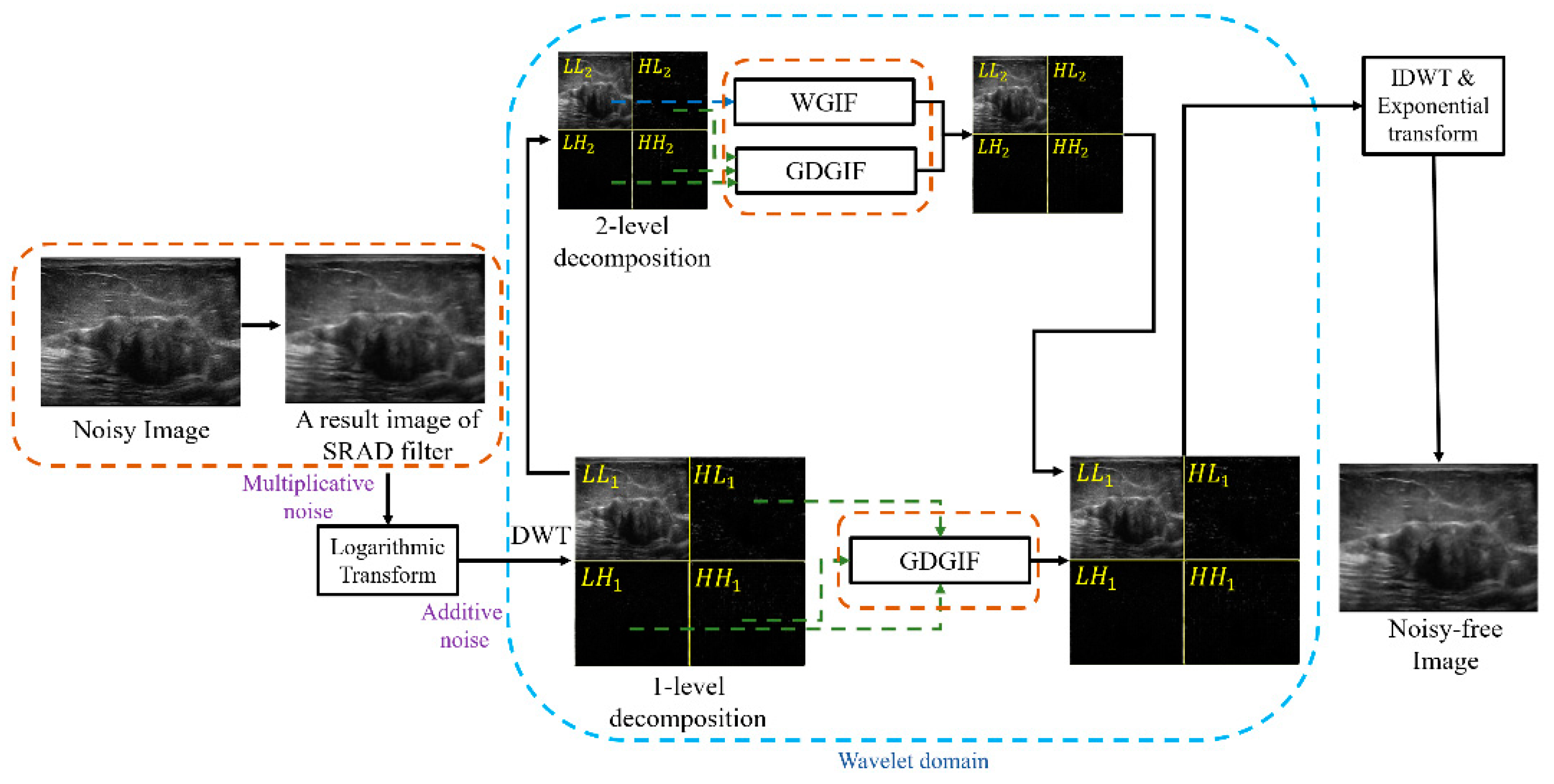Symmetry | Free Full-Text | Despeckling Algorithm for Removing Speckle Noise from Ultrasound Images
