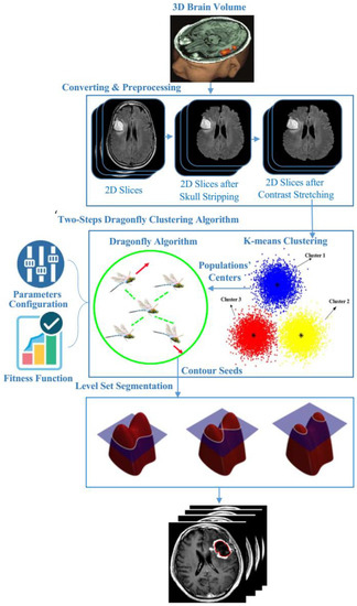 3D-MRI Brain Tumor Detection Model Using Modified Version of Level Set ...