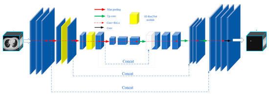 Segmentation of Lung Nodules Using Improved 3D-UNet Neural Network