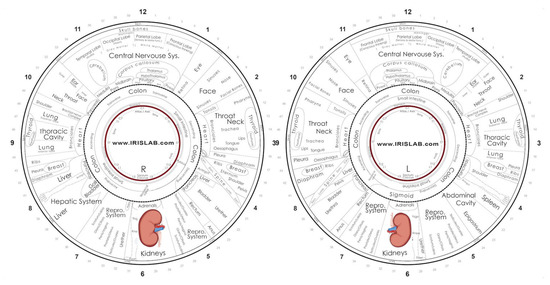 An Intelligent Iris Based Chronic Kidney Identification System
