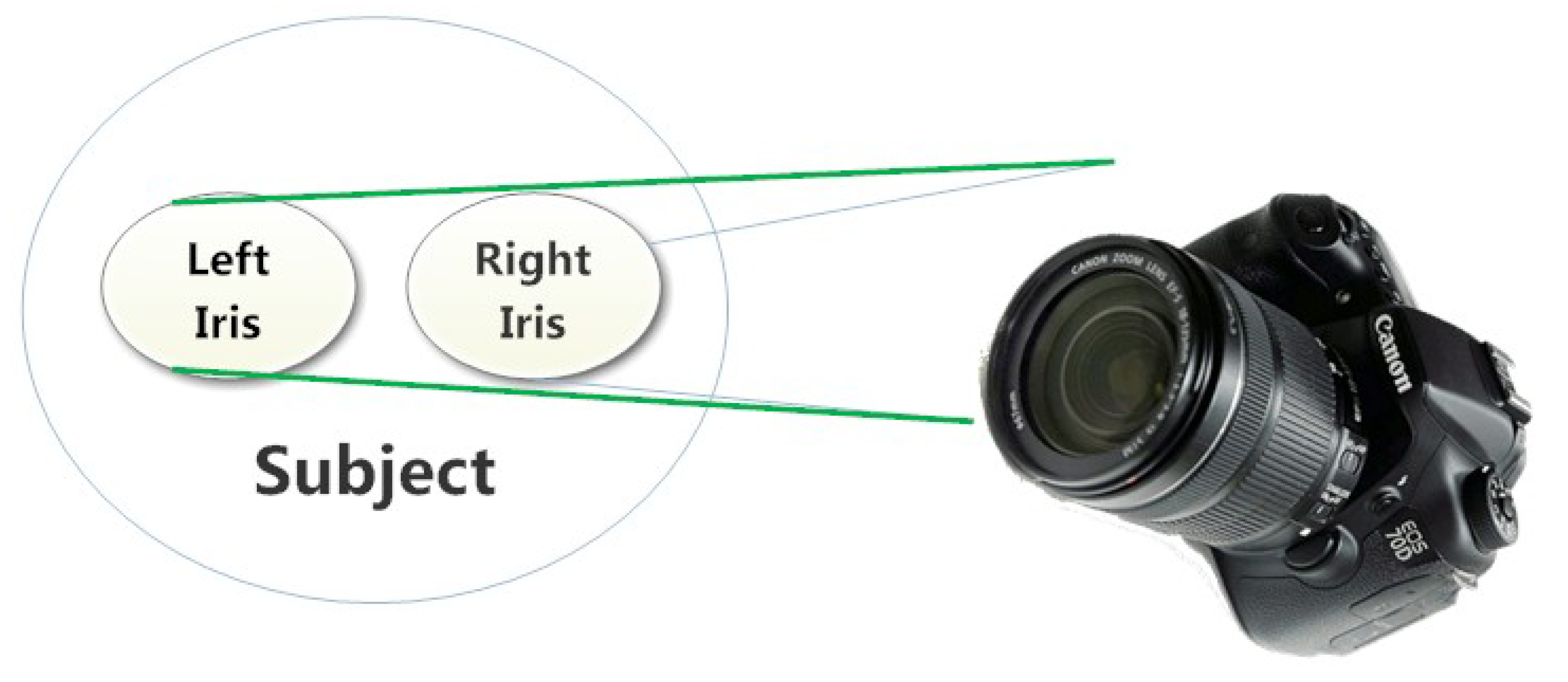 An Intelligent Iris Based Chronic Kidney Identification System