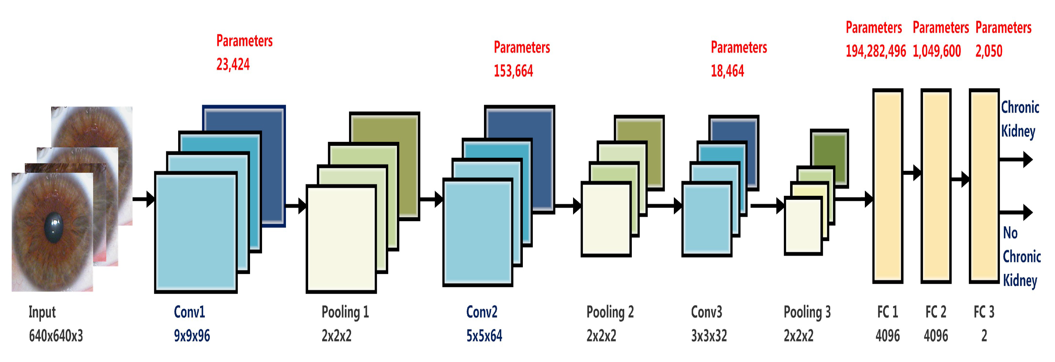 An Intelligent Iris Based Chronic Kidney Identification System