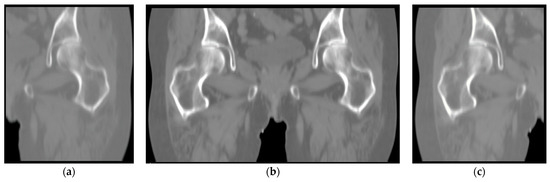 Symmetry | Special Issue : Multidimensional Signal Processing and Its Applications