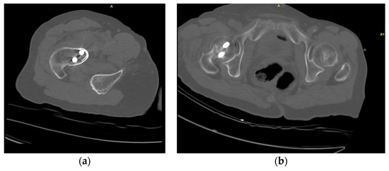Symmetry | Special Issue : Multidimensional Signal Processing and Its Applications