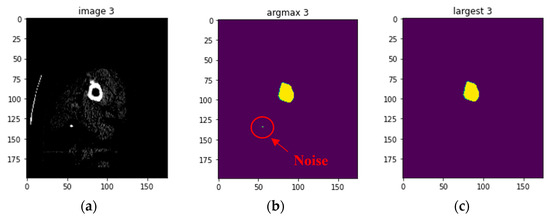 Symmetry | Special Issue : Multidimensional Signal Processing and Its Applications