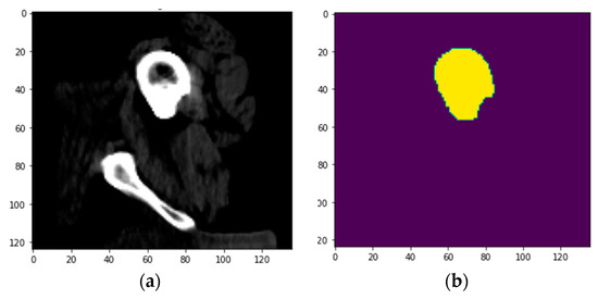 Symmetry | Special Issue : Multidimensional Signal Processing and Its Applications