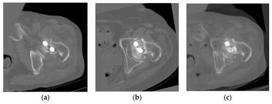 Symmetry | Special Issue : Multidimensional Signal Processing and Its Applications