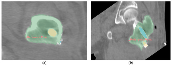 Symmetry | Special Issue : Multidimensional Signal Processing and Its Applications