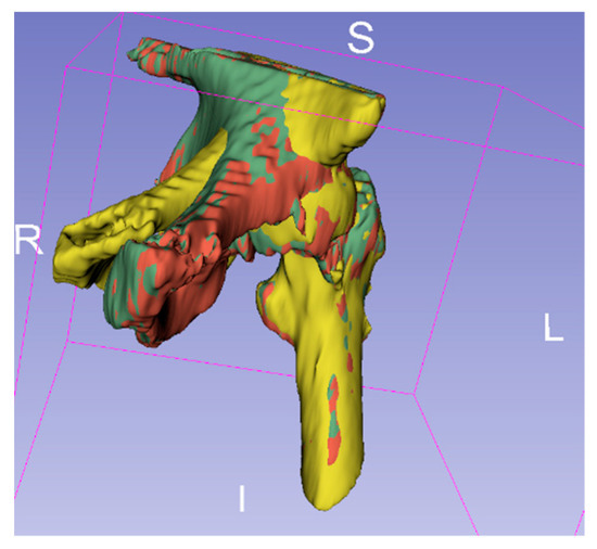 Symmetry | Special Issue : Multidimensional Signal Processing and Its Applications